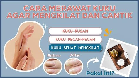 Cara Mudah Bisa Kalian Coba Untuk Mengatasi Permasalahan Kuku Yang Mudah Rapuh Agar Lebih