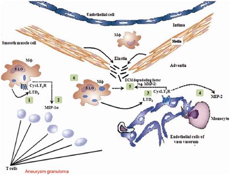 Model Of 5 Lipoxygenase 5 Lo Pathway Participatation In Leukocytes Download Scientific