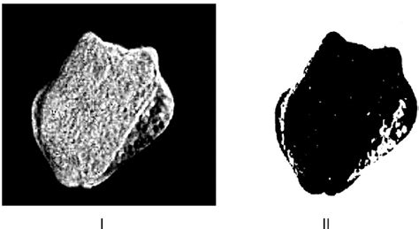 figure 8 from improved image segmentation algorithms for detecting types of acute lymphatic