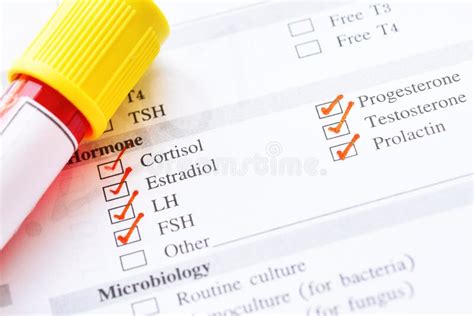 Blood Sample For Sex Hormone Test Stock Photo Image Of Care Fertilization 120569144