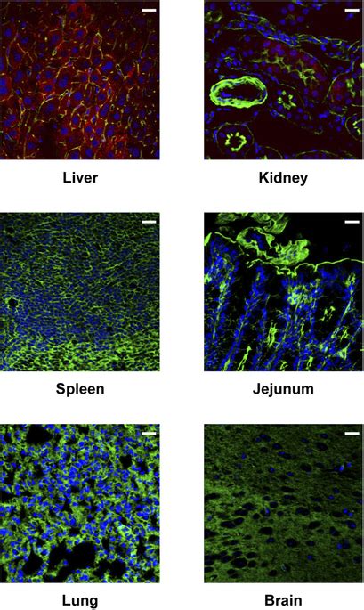Fluorescence Micrographs Of Various Mouse Organs 4 H After Colorectal Download Scientific