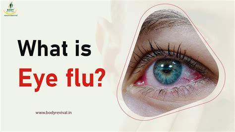 What Is Eye Flu The Causes Symptoms And Prevention Tips Body Revival
