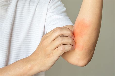 Diabetes Skin Symptoms That May Be Warning Signs