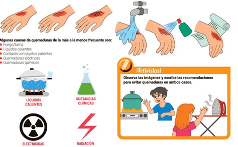 Qué Hacer Si Tienes Quemaduras 5 Consejos Para Atender A Un Herido