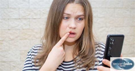 Understanding Hsv 2 Test Results Range