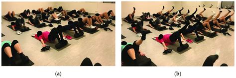 Segmental Stabilization In Unstable Bilateral A And Unilateral B