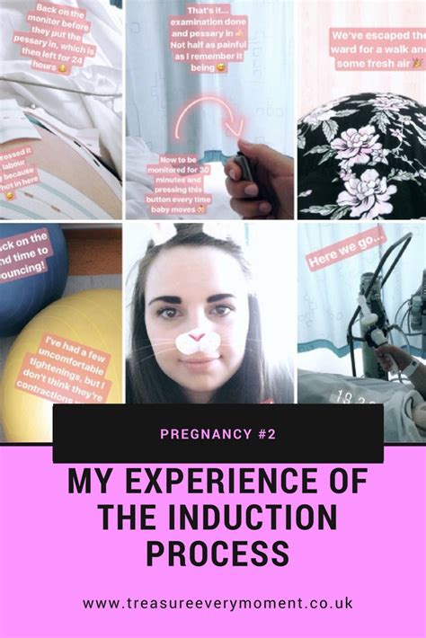 PREGNANCY My Experience Of The Induction Process Treasure Every Moment