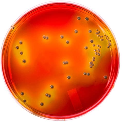 Hardy G09 Burkholderia Cepacia Selective Agar Bcsa