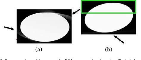 Figure 3 From Roi Reconstruction Of Motion Contaminated Data With A Backprojection Filtration
