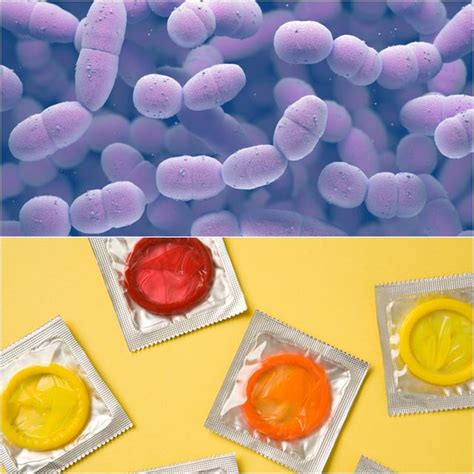 Sti Mycoplasma Genitalium Could Become Untreatable In 5 Years