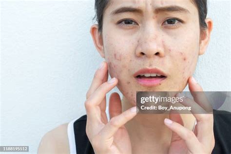 Ugly Asian Girl Photos And Premium High Res Pictures Getty Images
