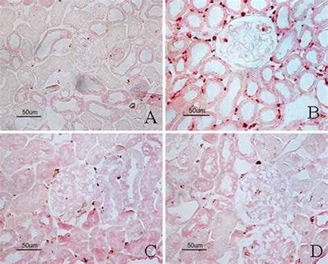 Double Immunostaining Of Ed 1 Inos The Representative Fields Show