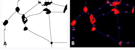 Computer Assisted Diagnosis Of Breast Cancer By Cell Network Matrix Extraction And Multilayer