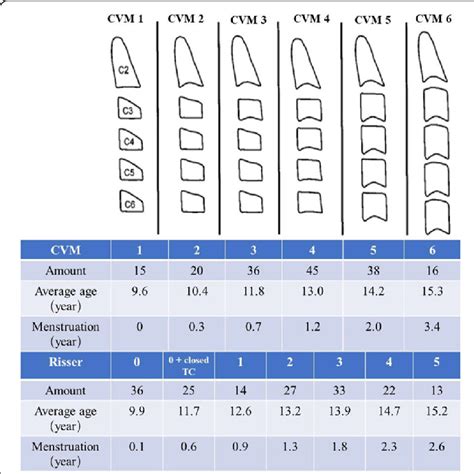 Abstract O6 Schematic Of CVM Stage And The Distribution Of Download Scientific Diagram