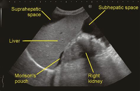 Anatomy Abdominal Flashcards Quizlet