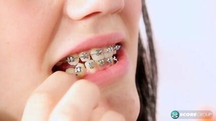 Sex Obsessed Slim Teen With Puffy Nips And Braces Spreads Wide Karly Baker