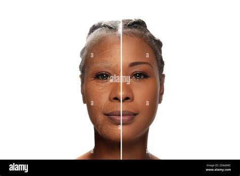 Comparison Portrait Of Beautiful African Woman With Problem And Clean