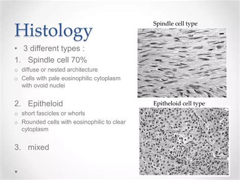 Gastrointestinal Stromal Tumour Gist D1 Pptx Digestive Disorders Diseases And Conditions