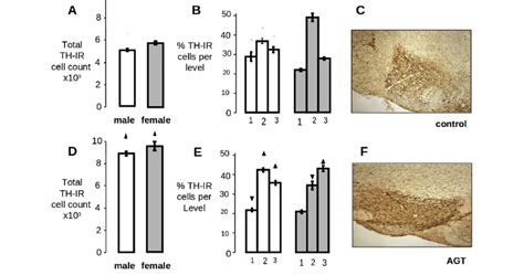 Sex Differences And Impact Of Antenatal Glucocorticoid Treatment AGT