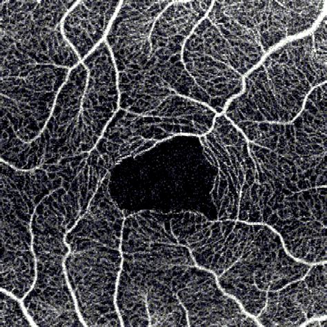 Angiography Optopol Technology Ophthalmic Diagnostic Equipment