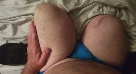 Dak Amputee Man Stumps