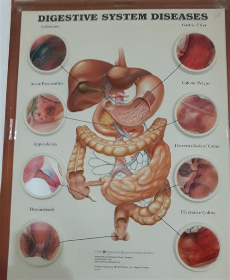 Digestive System Common Diseases
