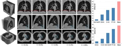 논문 리뷰 X 2 Gaussian 4d Radiative Gaussian Splatting For Continuous Time Tomographic