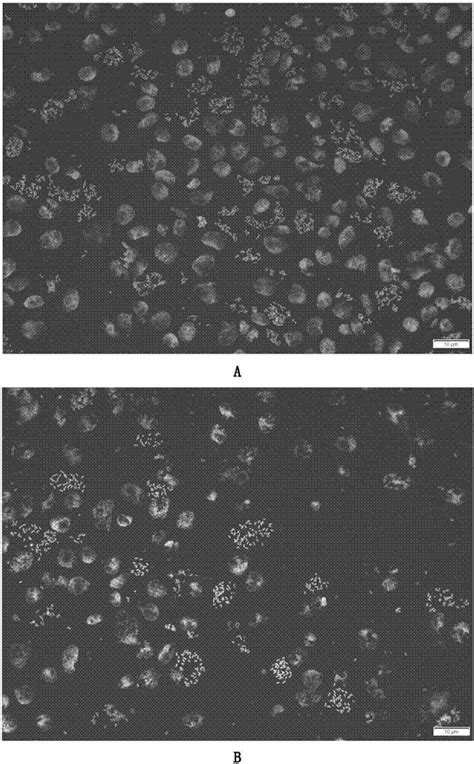 Preparation Method Of Wheat Root Tip Chromosome Slice Eureka Patsnap