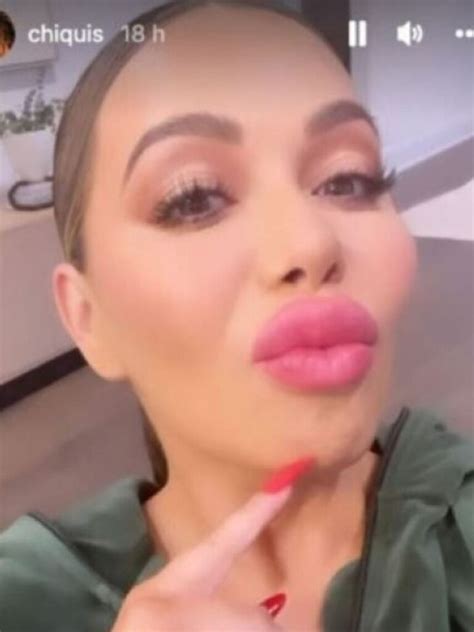 Chiquis Rivera Apareció Con Los Labios Hinchados Por Un Tratamiento