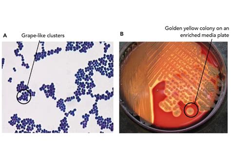 Enhanced In House Mrsa Testing Algorithm For Detecting Pvl Toxins