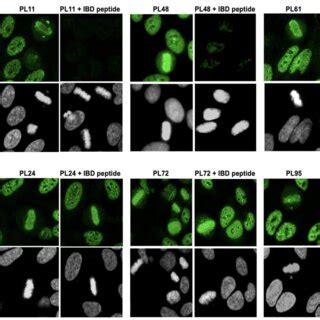 Enlarged Fields Showing The Co Localization Of The IFA Patterns Download Scientific Diagram