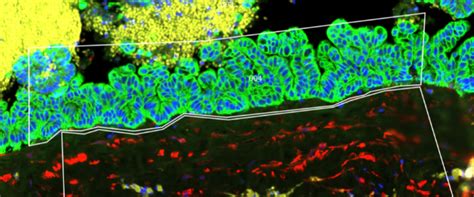 digital spatial profiling duke biorepository and precision pathology center