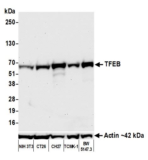 Buy Anti Tfeb Antibody For Sale Online Mybiosource
