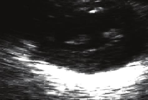 B Reconstructed Signal Download Scientific Diagram