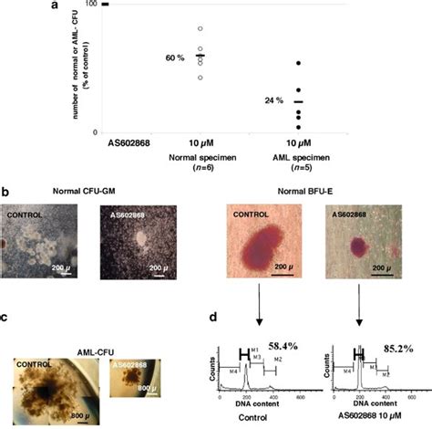 Preclinical Targeting Of Nf κb And Flt3 Pathways In Aml Cells Leukemia