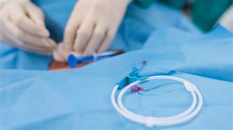 Postavljanje I Previjanje Centralnog Venskog Katetera Meditex