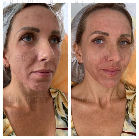 Косметолог Новосибирск