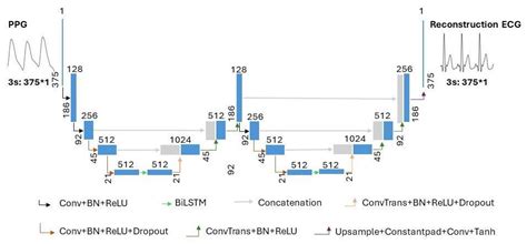 Reconstruction Of Missing Electrocardiography Signals From Photoplethysmography Data Using Deep