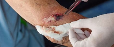 How To Identify The Difference Between Laceration Vs Abrasion During