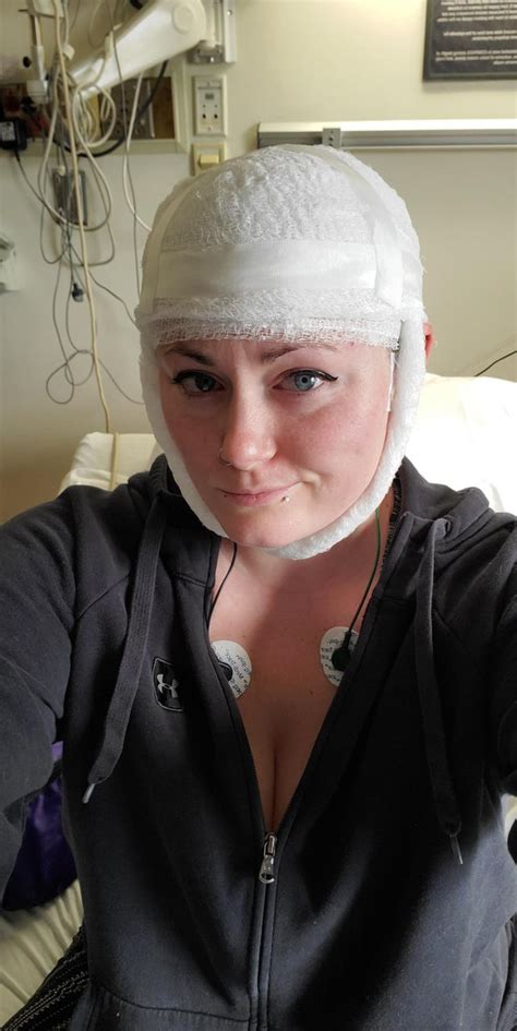 I Might Finally Get Some Answers R Epilepsy
