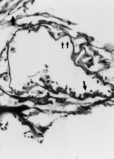 Photomicrograph Of Tissue Revealing Elongated Unimultilayered