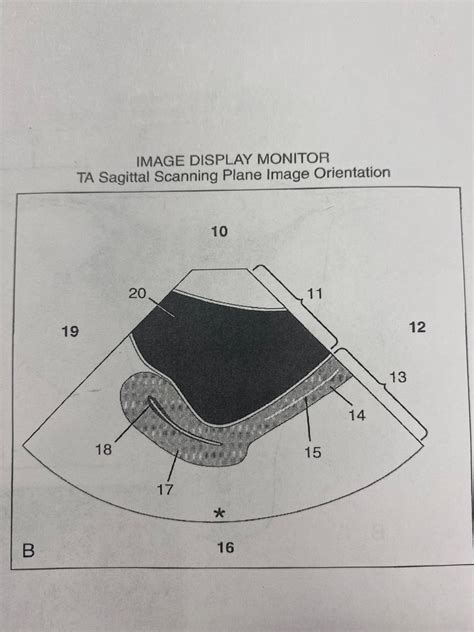 Gyn Test 1 Diagram Quizlet