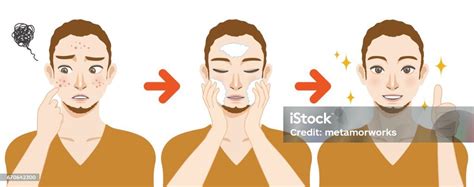 어린 소년 여드름 치료 전후 페이셜 클렌징 폼 남자 피부 관리 만화 일러스트 레이 션 가리키기에 대한 스톡 벡터 아트 및 기타 이미지 가리키기 건강관리와 의술