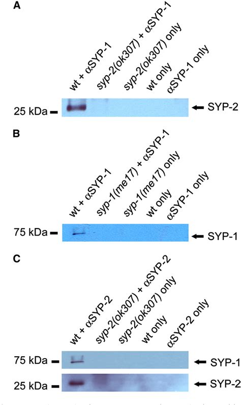 Figure 2 From Organization Of The Synaptonemal Complex During Meiosis