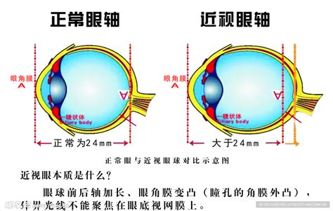 眼轴示意图设计图 海报设计 广告设计 设计图库 昵图网