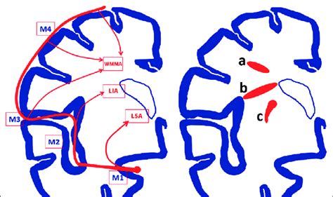 Vascular Territories Of Perforating Arteries And Their Infarct Download Scientific Diagram