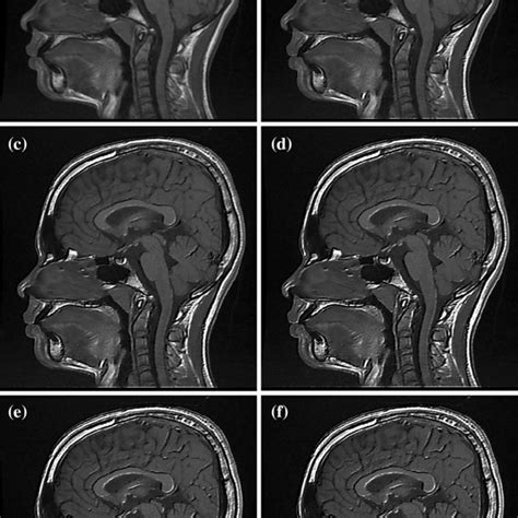 A Absolute Spectrum Of The Sharpening Kernel In 8 For K 10 And B Download Scientific