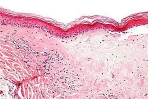 Female Genital Tract Flashcards Quizlet