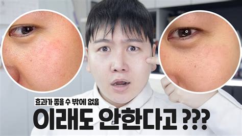 알려주기 아까운 피부 뒤집어졌을 때 5일만에 피부 좋아지는 법 Youtube