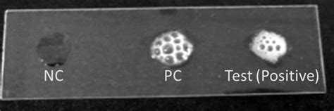 Staphylococcus Aureus Catalase Test